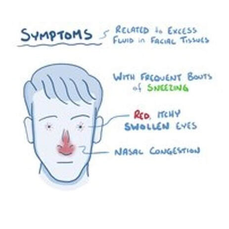 Non-allergic Rhinitis – The Childrens Allergy | Private Paediatric ...